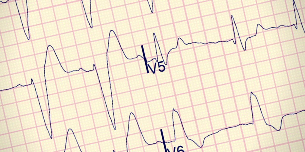 PROCAMIO – The Bottom Line