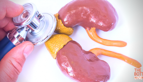 REDUCE – The Bottom Line