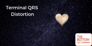 Terminal QRS distortion – The Bottom Line
