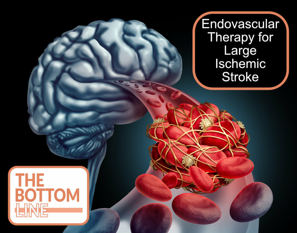 Endovascular Therapy for Large Ischemic Stroke – The Bottom Line